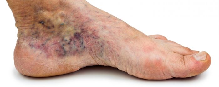 Diabetics Feet Self Care Guide - Claremont Podiatry
